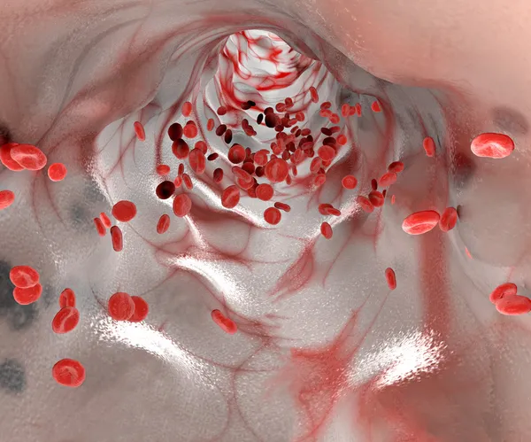 Patología Vascular | Genially