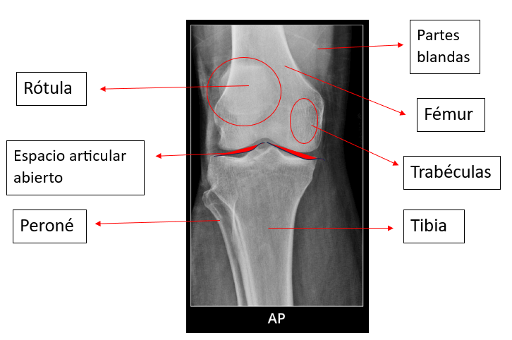 Anatomía De La Radiografía De La Rodilla