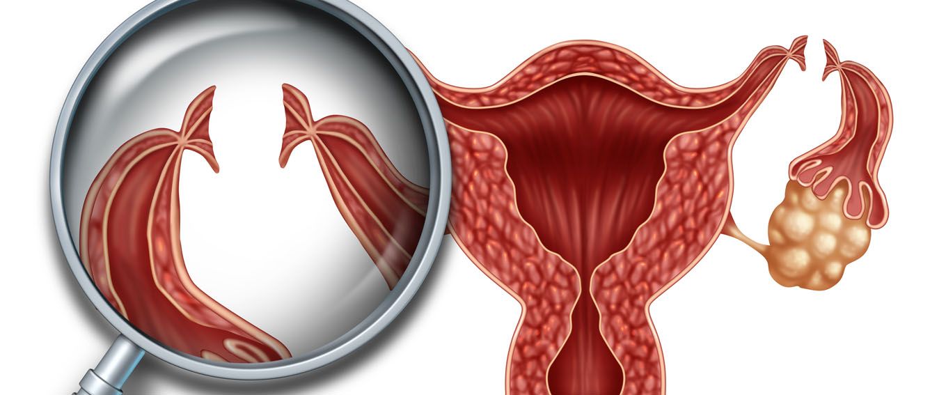 METODOS ANTICONCEPTIVOS | Genially