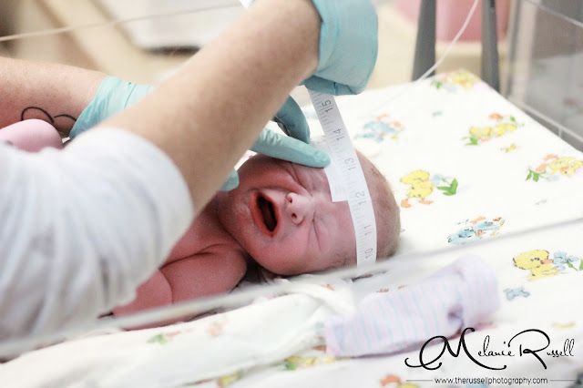 Sindrome dandy walker