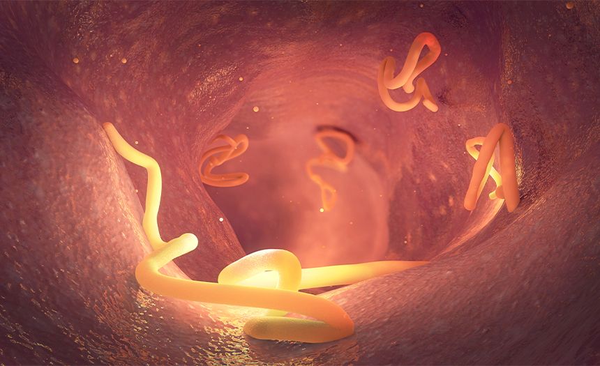 Cisticercosis - Infografía