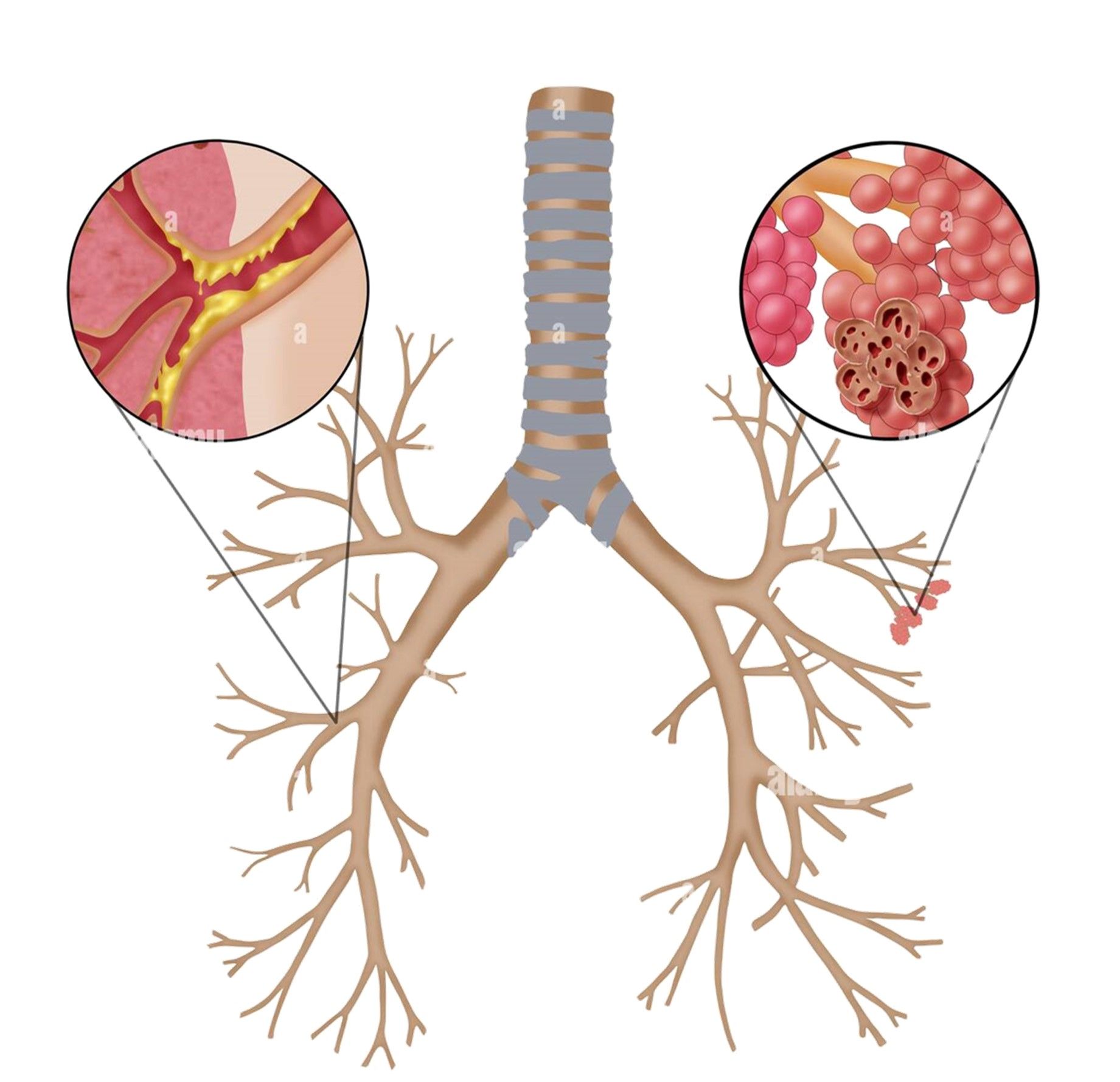 MAPA MENTAL - EPOC | Genially