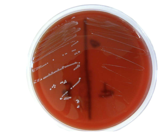 Enterococcus Faecium Vs. Faecalis En Agar Sangre PDF) Phenotypic And