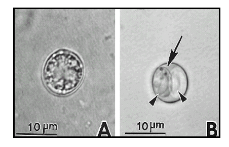 MAPA MENTAL NEOSPORA | Genially