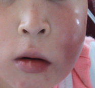 Doctor, ¿Qué me pasa? | Genially