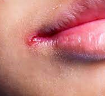 Doctor, ¿Qué me pasa? | Genially