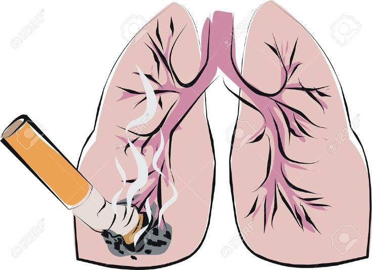 MAPA MENTAL EPOC | Genially
