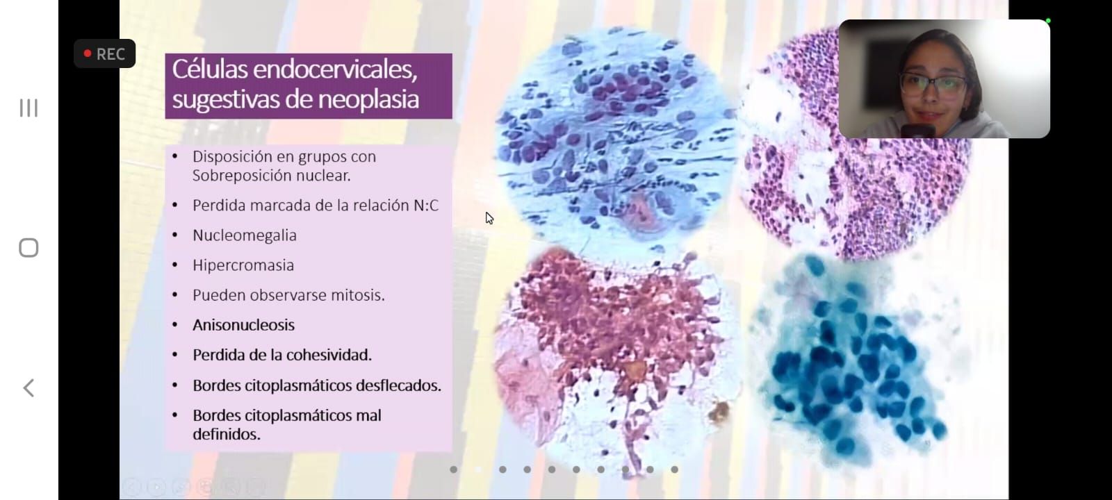 INFO ONDULADA | Genially