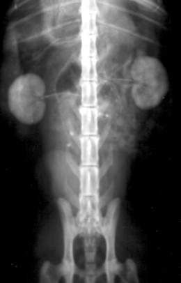 Pielograma Secuencia Rápida