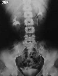 Pielograma Secuencia Rápida | Genially