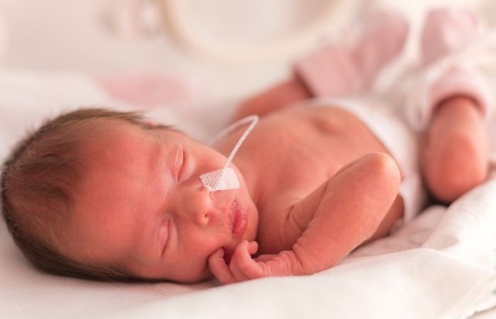 Actividad practica Anemia Neonatal