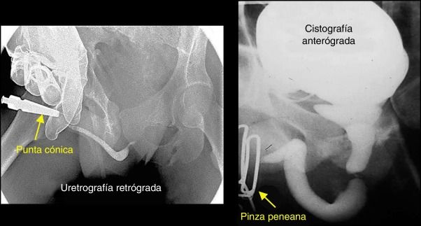 UROGRAFIA RETROGRADA | Genially