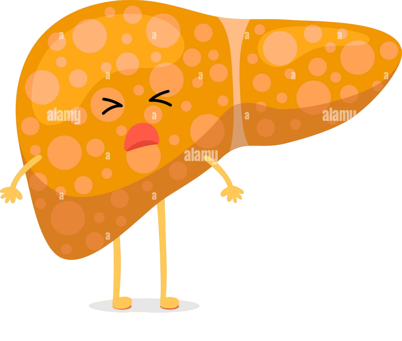 PRESENTACIÓN HEPATITIS | Genially