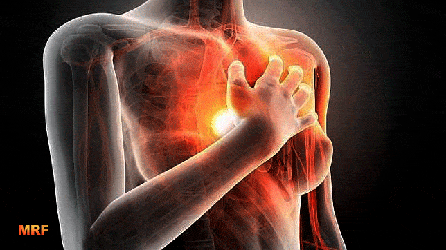 ANGINA DE PECHO 1967400 | Genially
