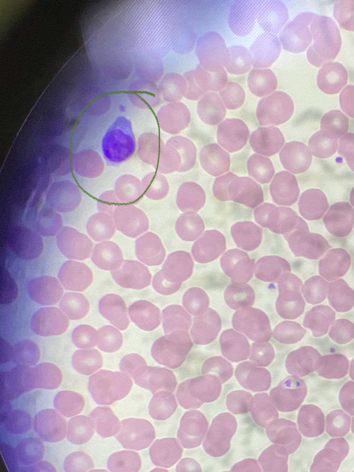 Blood Formed Elements | Genially